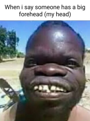 Big Forehead Memes: Hilariously Relatable and Too Funny to Miss - AMJ