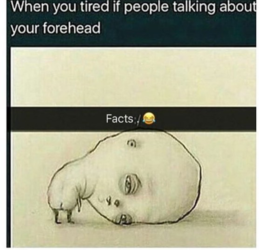 Big Forehead Memes: Hilariously Relatable and Too Funny to Miss - AMJ
