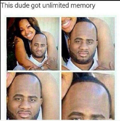 Big Forehead Memes: Hilariously Relatable and Too Funny to Miss - AMJ