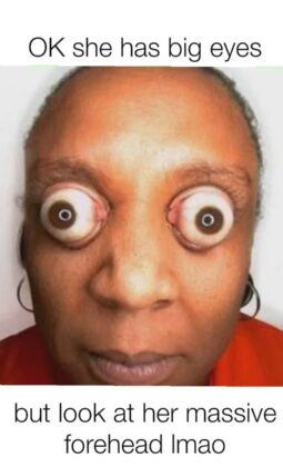 Big Forehead Memes: Hilariously Relatable and Too Funny to Miss - AMJ